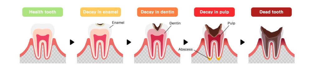 Dental Anatomy - Taylor Made Dental